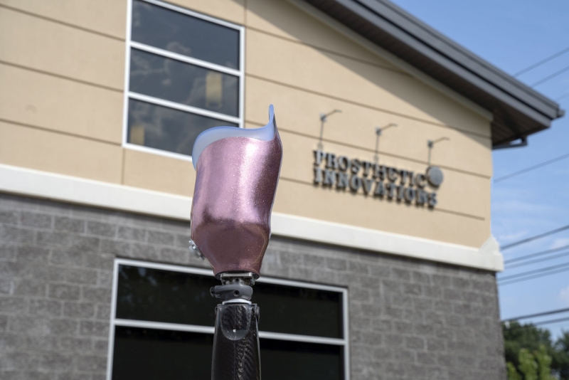 Pink Glitter Socket!! | Prosthetic Innovations